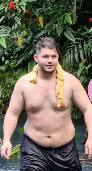 Spatz3 Reviews | Gastric Balloon Before and After