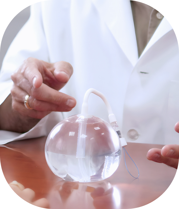 Expectation From Spatz Gastric Balloon | Lose Weight System