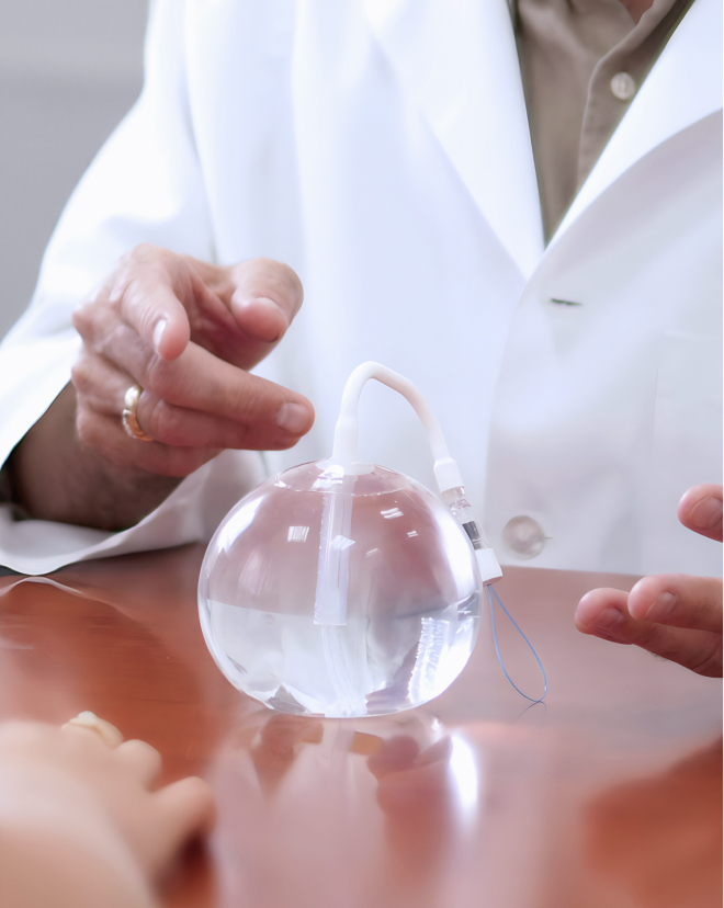 Gastric Balloon For Weight Loss: All You Need to Know | Spatz3